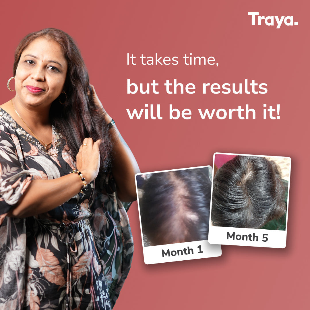 Traya Hair Treatment Explained: What’s in the Kit & Why It Works