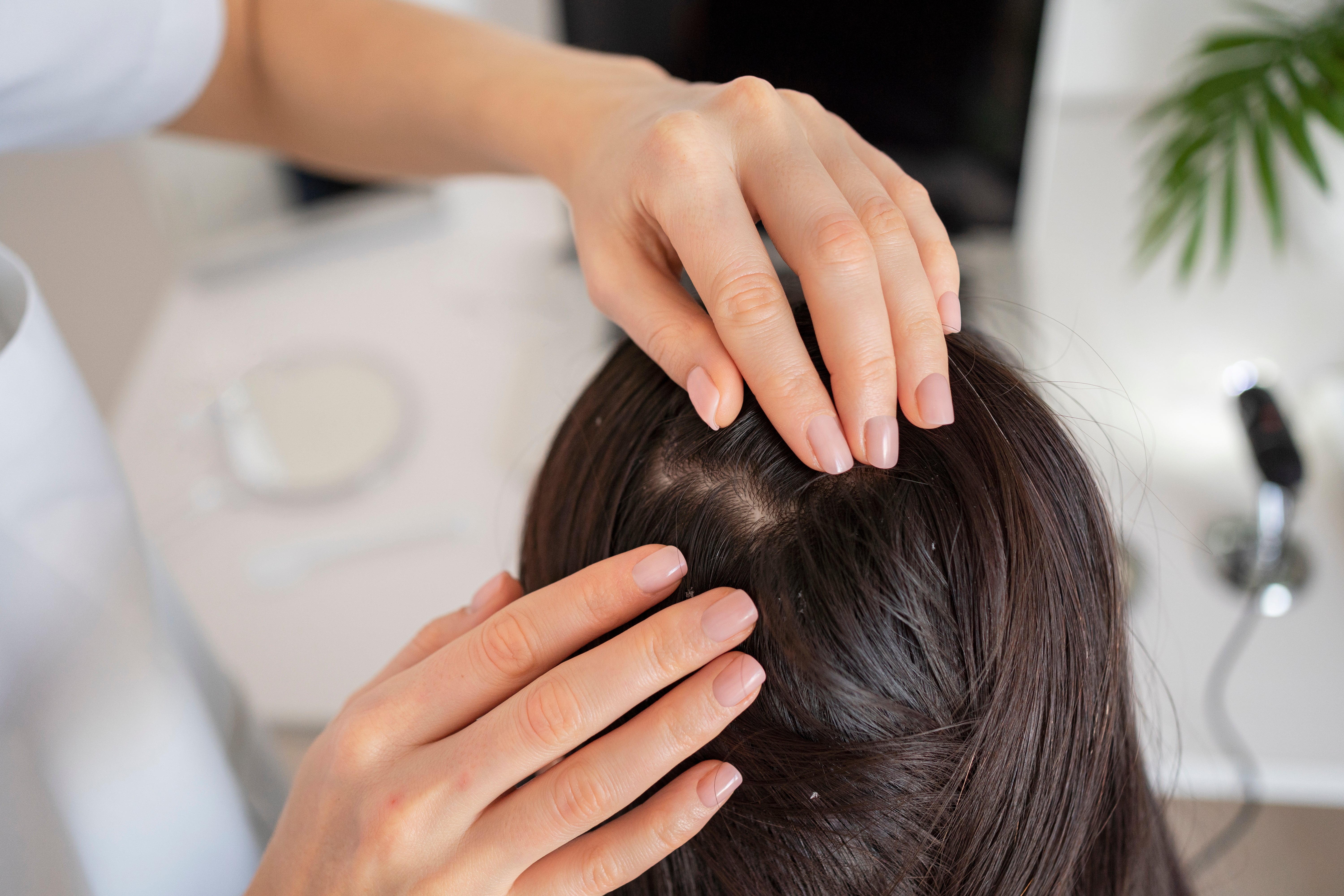 Best Ways to Remove Dandruff Fast at Home – Traya