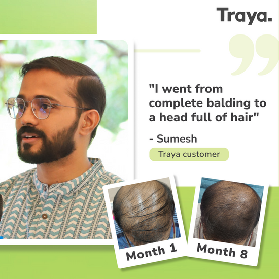 Traya Hair Kit Review: Honest Results & Real Experiences