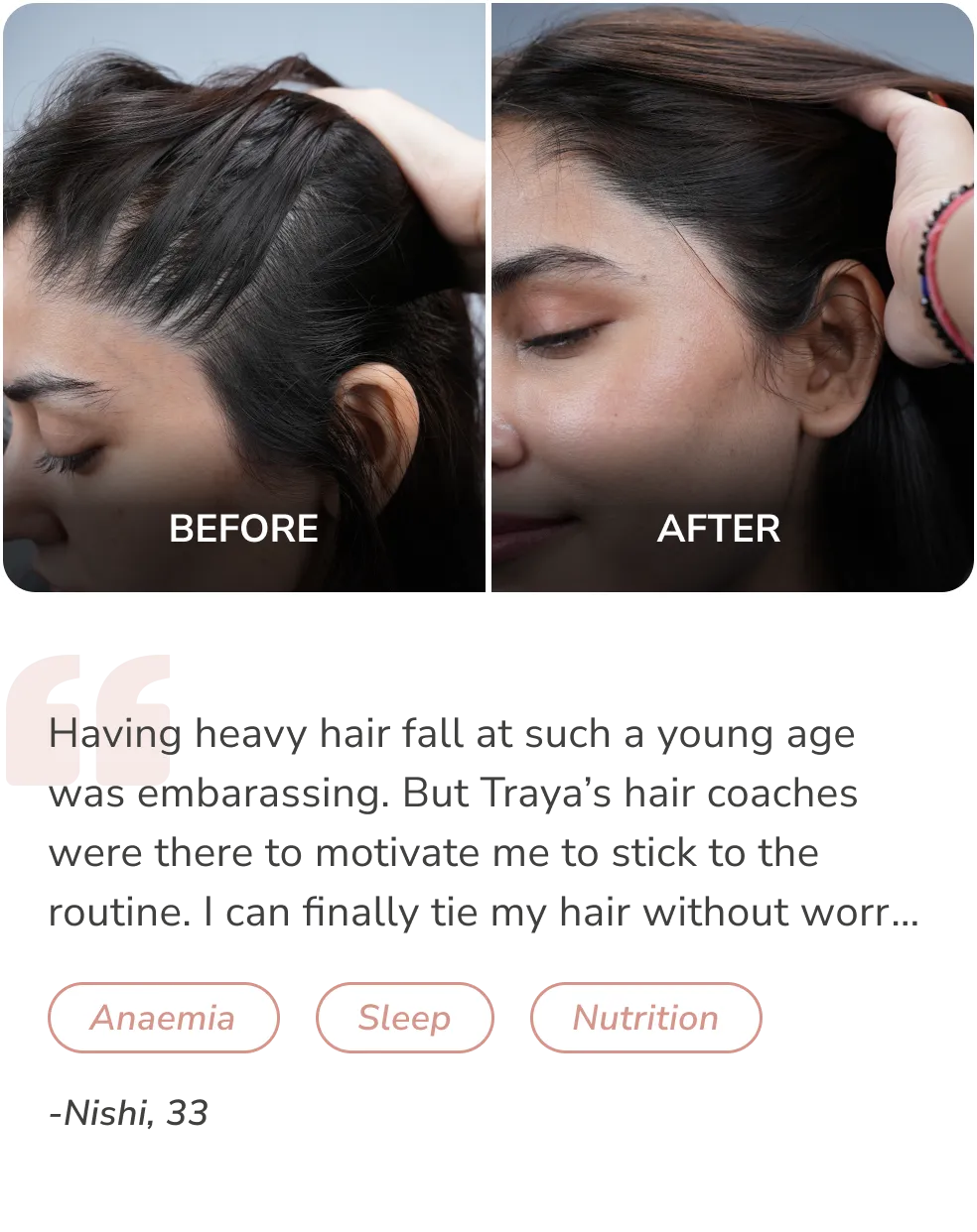 Hair Loss Treatment for Women - Holistic Hair fall Solutions for Females – Traya